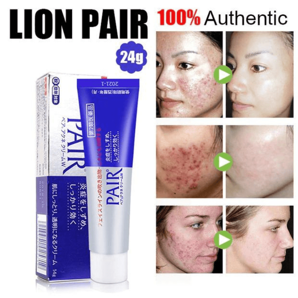 Lion Pair Acne Cream كريم ليون بير لحب الشباب – Princess Cosmetics Qatar
